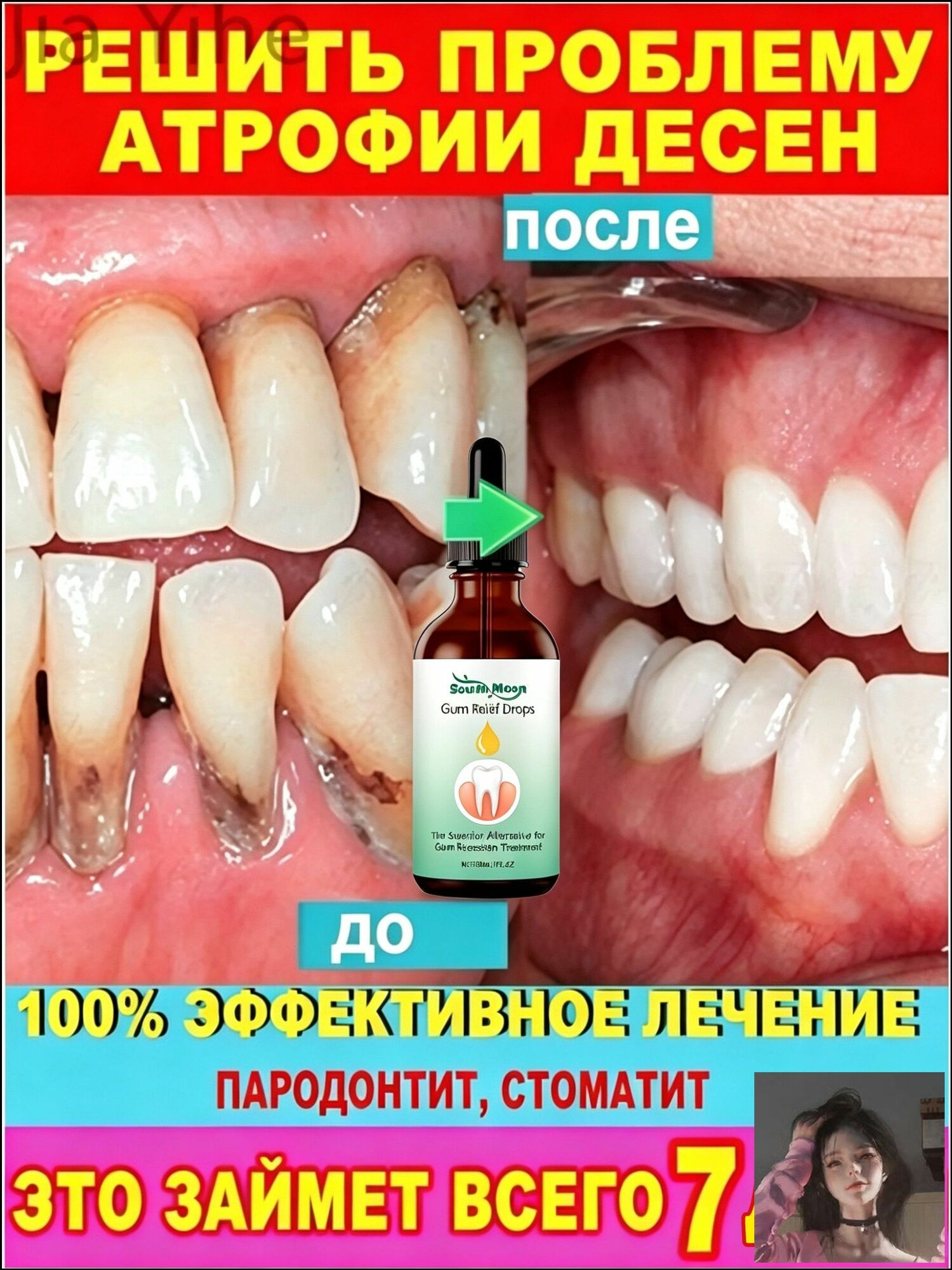 Устраняет кровоточивость десен, предотвращает атрофию, уменьшает разрывы, Наносите на зубы и десны для комплексного ухода за полостью рта, 30 мл