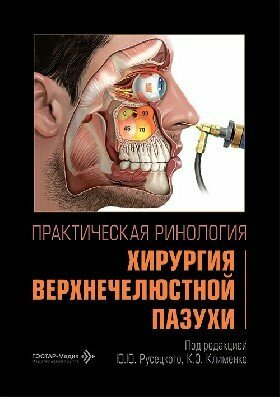 Практическая ринология: хирургия верхнечелюстной пазухи / Русецкий Ю. Ю, Клименко К. Э.