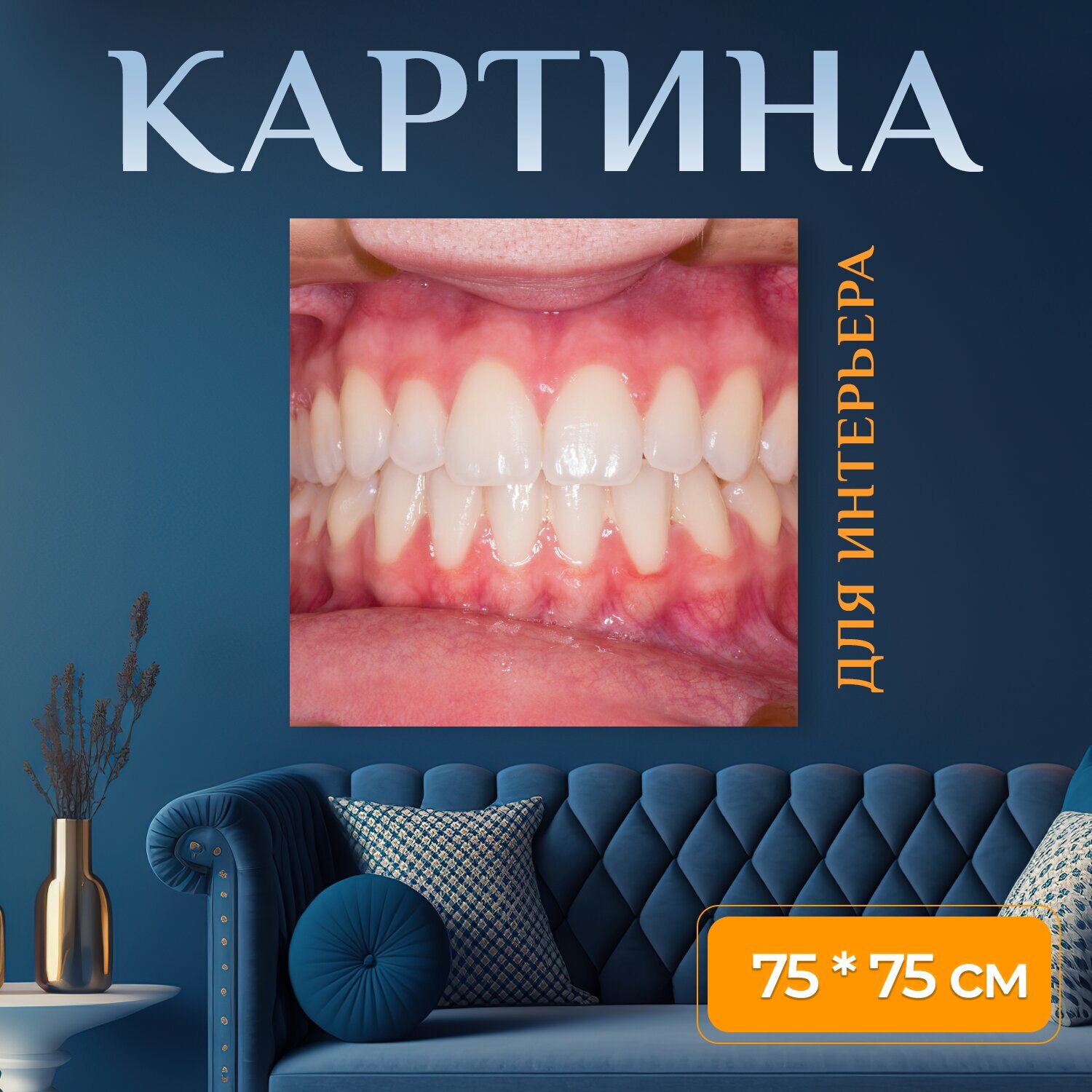 Картина на холсте "Зубы, улыбка, дантист" на подрамнике 75х75 см. для интерьера