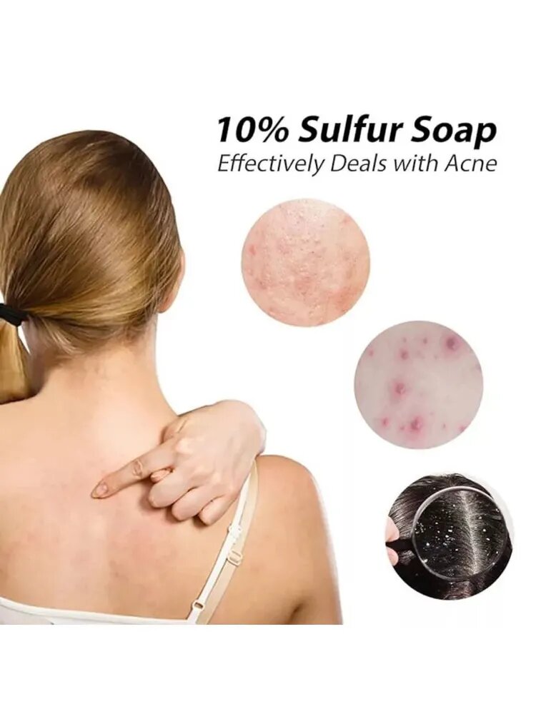 Твердое мыло — фото 1