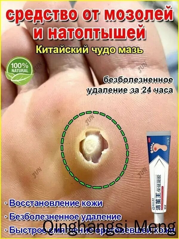 Пластырь от мозолей, бородавок и натоптышей лечебный, быстрое смягчение, безболезненное удаление,20 г.