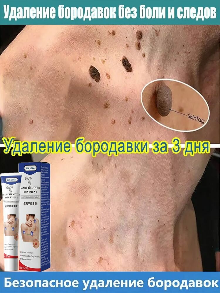 Крем от бородавок 20г Для лечения бородавок, папиллом, мозолей на теле и лице Чистотел Безопасно и без побочных эффектов