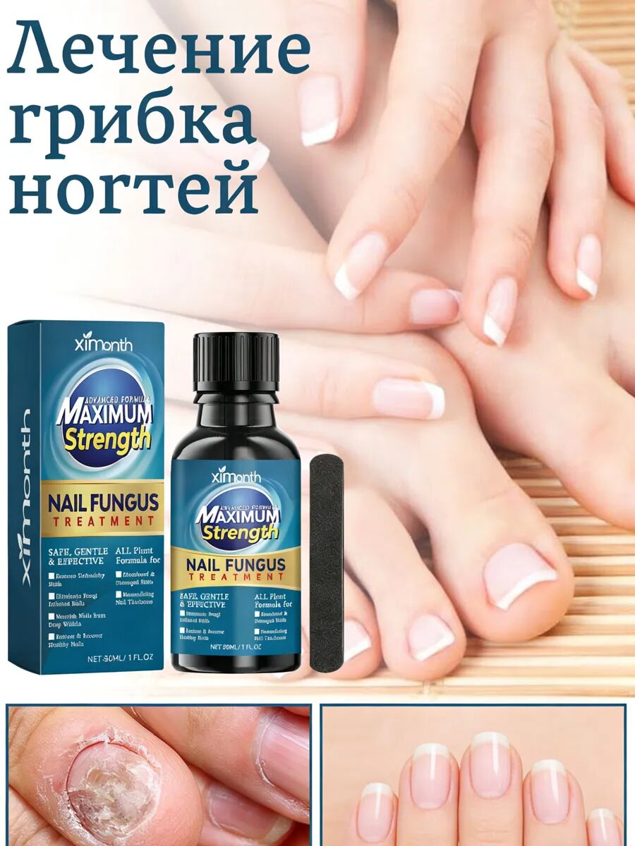 Противогрибковая жидкость для ног и ногтей