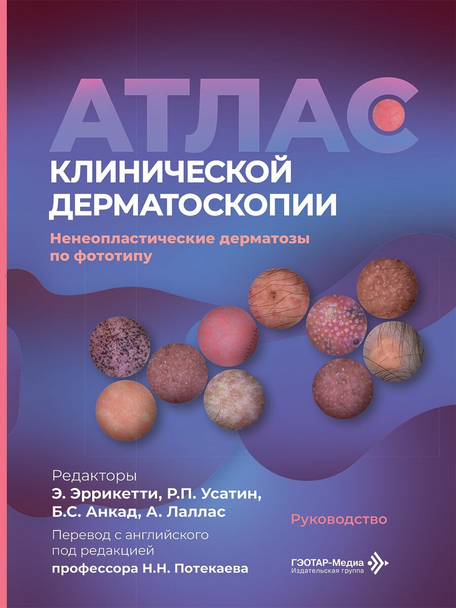 Атлас клинической дерматоскопии. Ненеопластические дерматозы по фототипу. Руководство