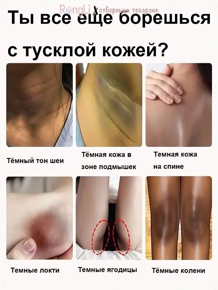 Твердое мыло — фото 1