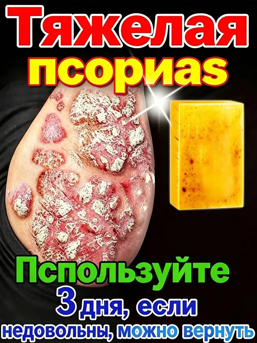 Мыло от псориаза лечебное