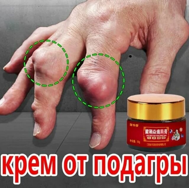 Мазь при вальгусной деформации стоп, подагре и шишках