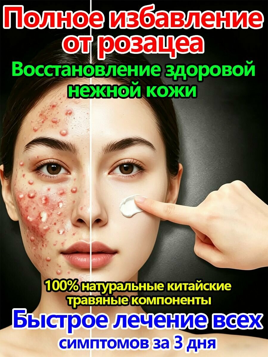 Мазь от Китайский розацеа на лице купероза и покраснений