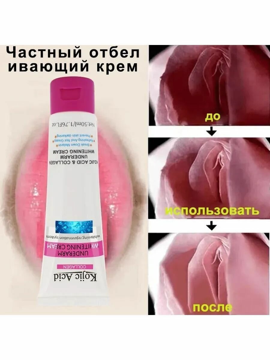 3 шт. крем для подмышек отбеливающий, Отбеливающий крем для тела, Для интимных зон, бедер, голеней, подмышек и локтей, против пигментации, омолаживающий3*50 г.