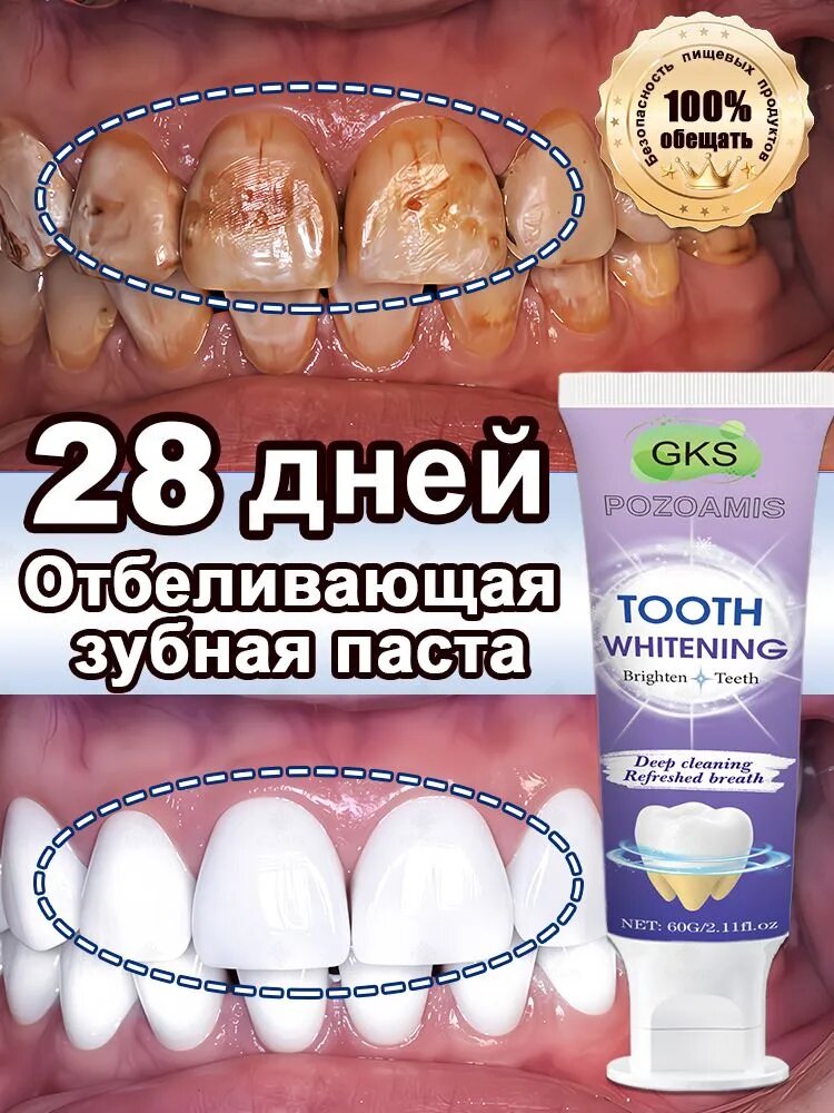 Комплексная зубная паста для десен и отбеливания, против зубного камня, от налета от кофе и сигарет, для чувствительных зубов, устранение неприятного запаха, 180 мл