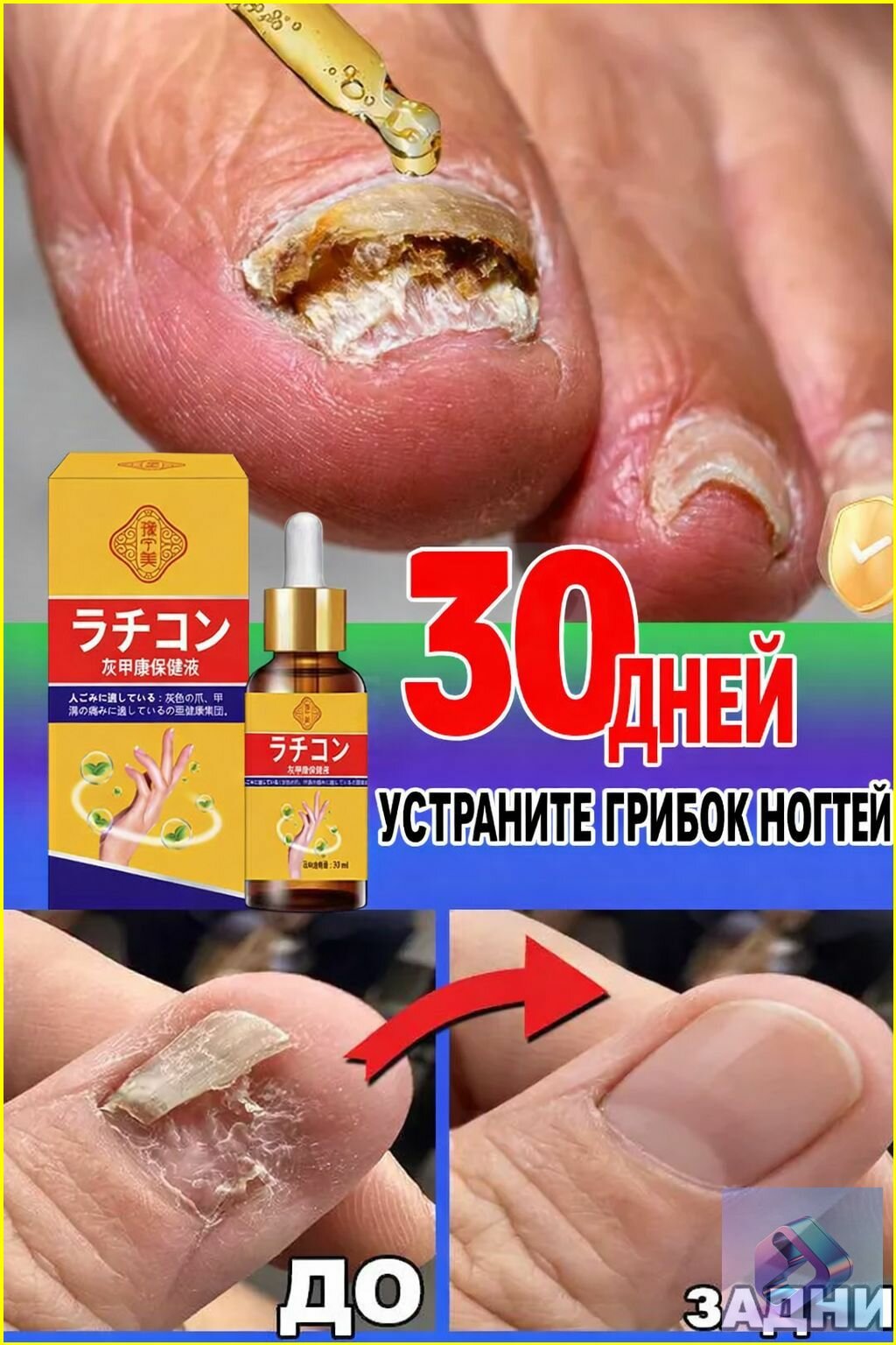 Эффективное средство для лечения грибковой инфекции ногтей на ногах, 30 мл