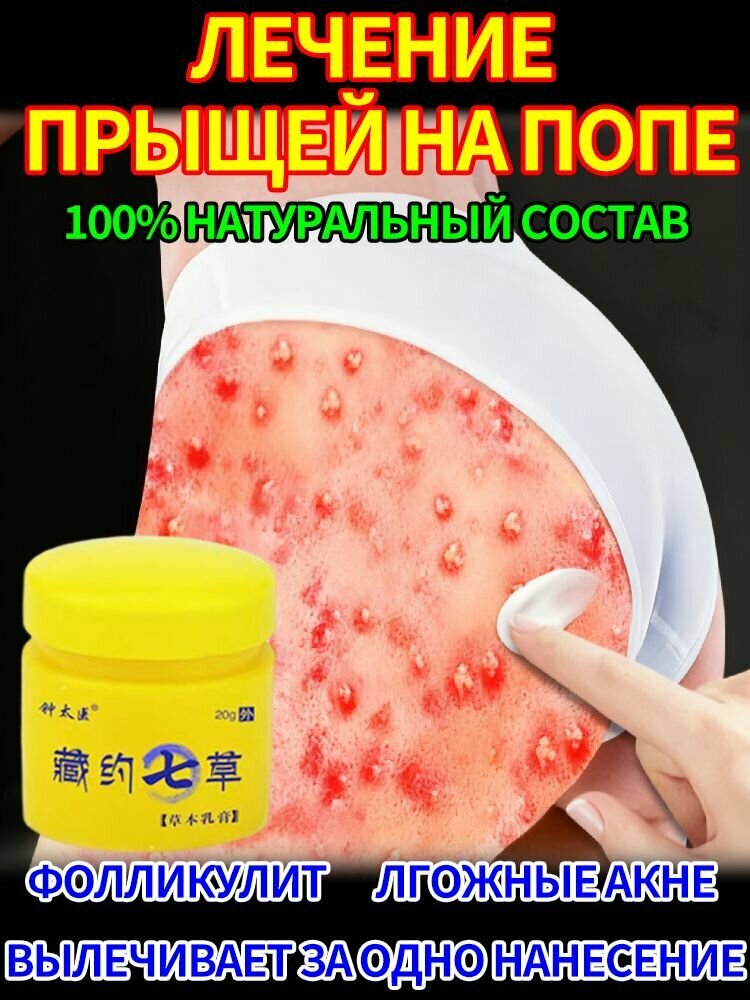 Мазь от прыщей на попе/Китайская Чудо мазь,20 мл /Устранение розовой сыпи на ягодицах /bосстанавливающий крем для кожи /nредназначен для чувствительной кожи