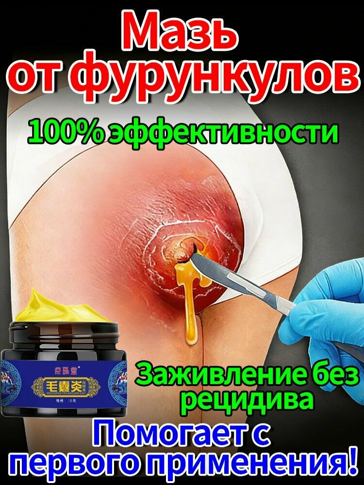 Вытягивающий Мазь от фурункулов, акне и гнойников, Китайская чудо мазь. Быстрый эффект. натуральный состав.30 г