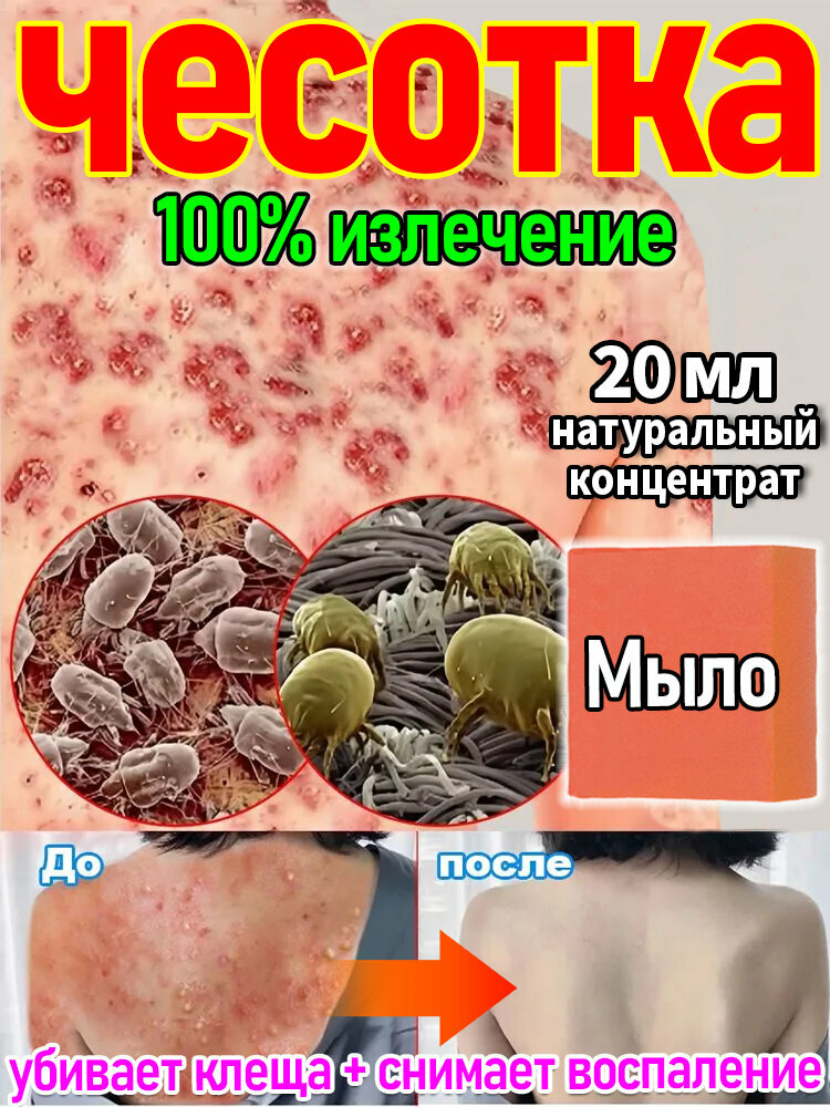 Мазь мыло от клеща для человека, на основе серы и дегтя