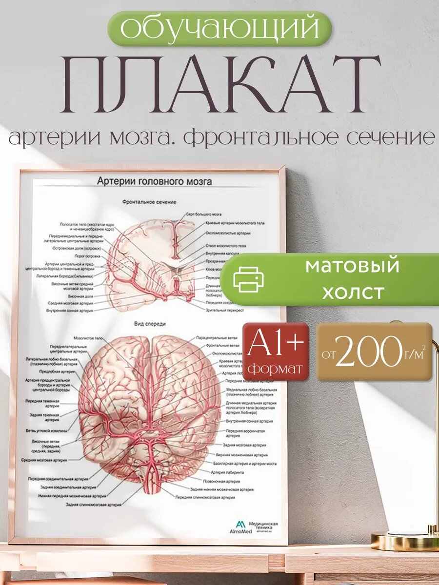 Артерии мозга. Фронтальное сечение, плакат А1+, матовый холст от 200г/м2