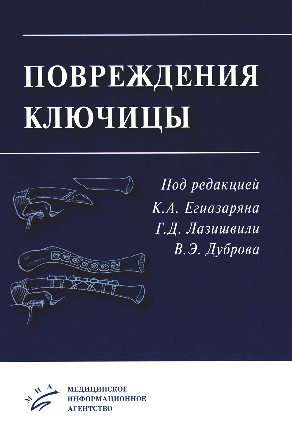 Уценка Повреждения ключицы: Учебное пособие. Под ред. Егиазаряна К.А., Лазишвили Г.Д., Дуброва В.Э.