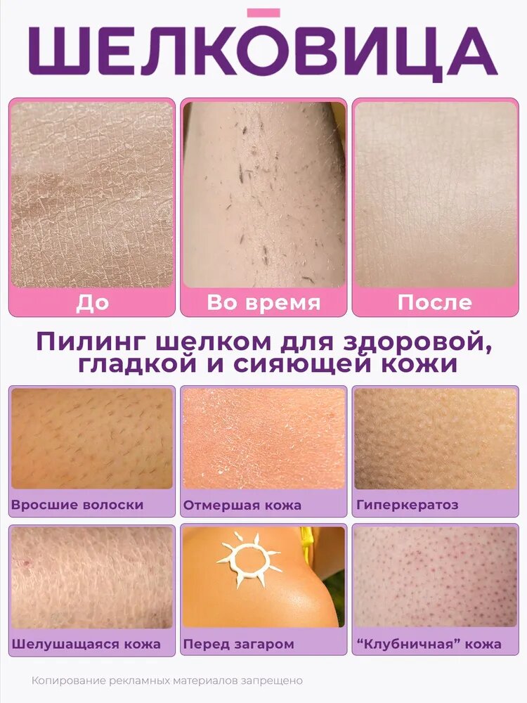 Мочалка — фото 1