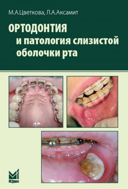 Ортодонтия и патология слизистой оболочки рта. Аксамит Л. А, Цветкова М. А.
