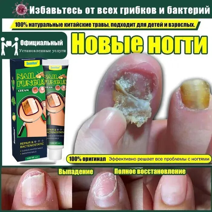 Мазь от грибка ногтей на ногах, Предотвращает бактериальные инфекции, способствует росту ногтевых пластин, ухаживает за ногтями 30г.