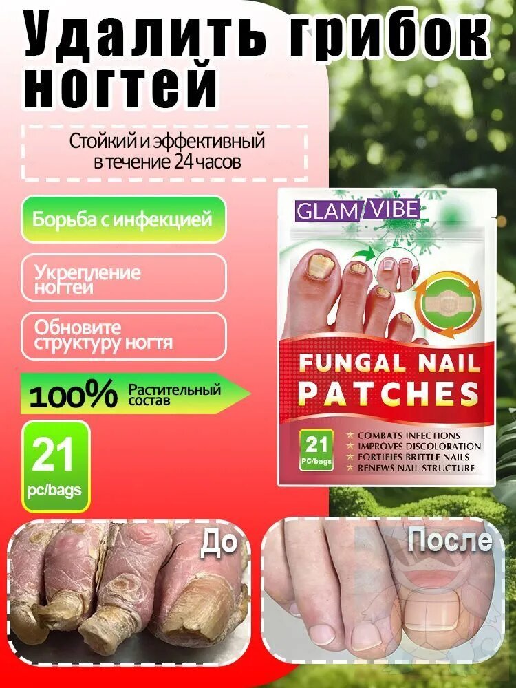 Противогрибковые пластыри для ногтей и кутикулы, эффективные против онихолизиса. Средства для маникюра и педикюра: наклейки для ногтей.
