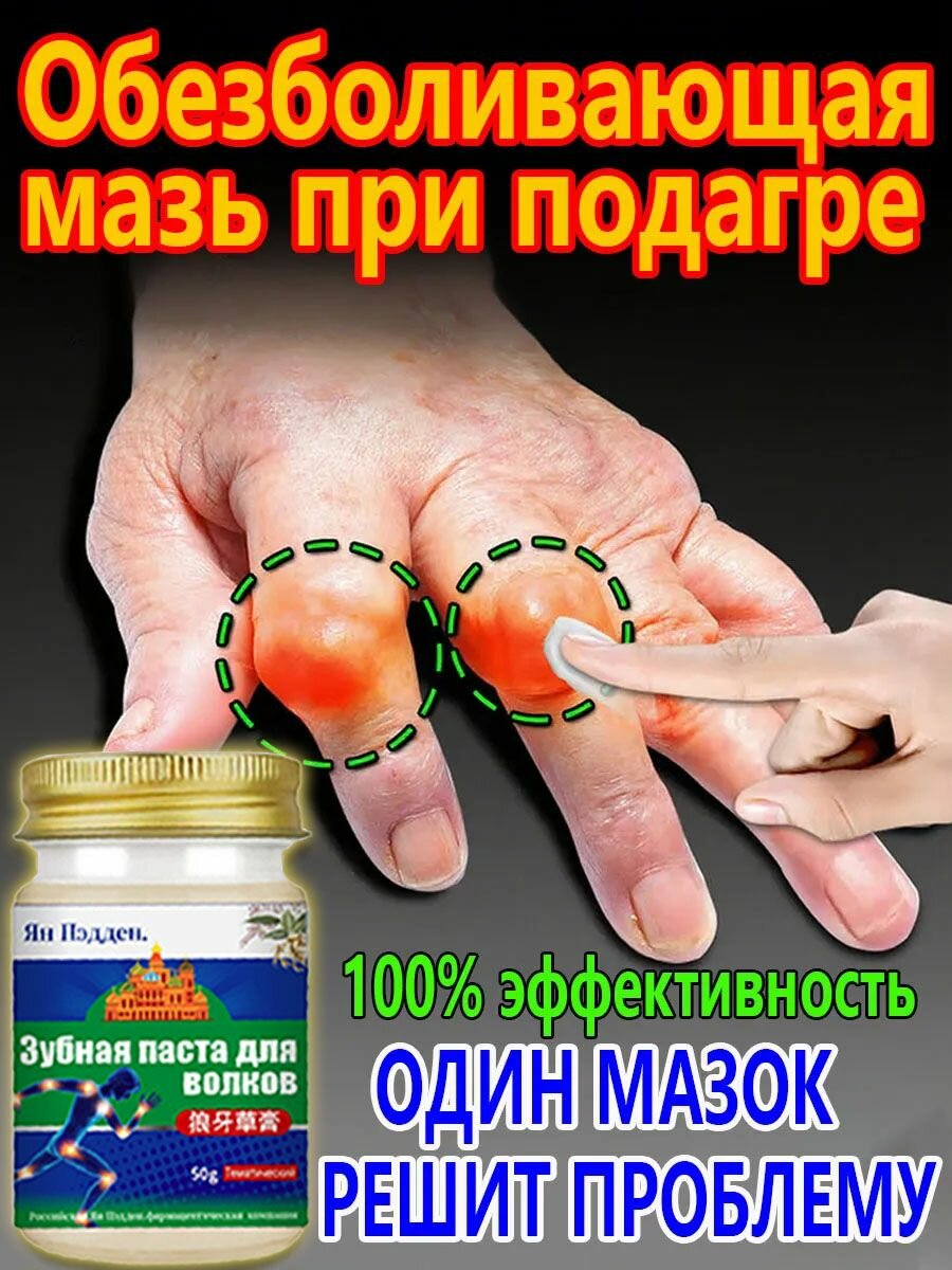 Мазь для суставов артрит пальцев рук
