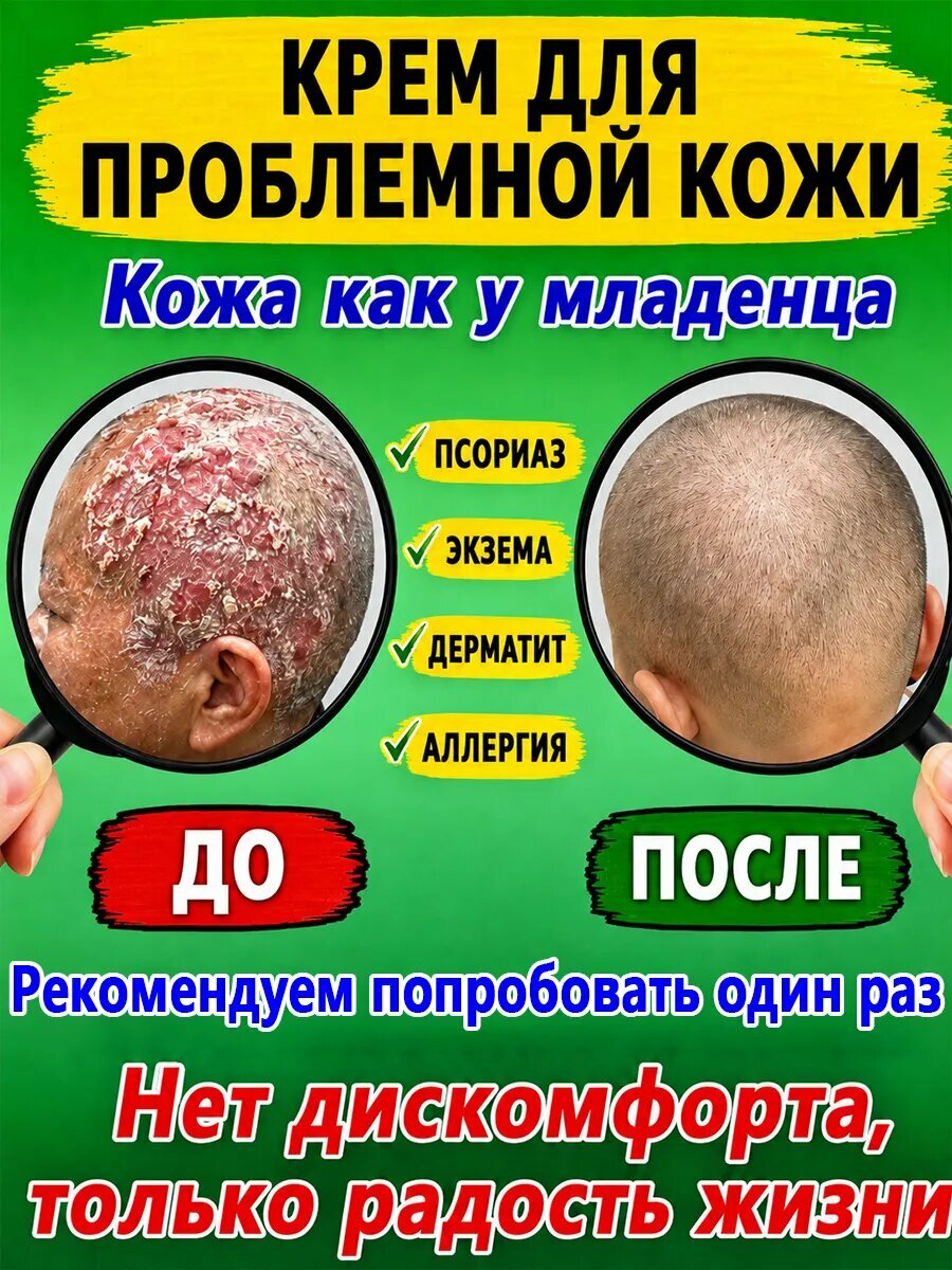Мазь Монастырская от псориаза 50 г