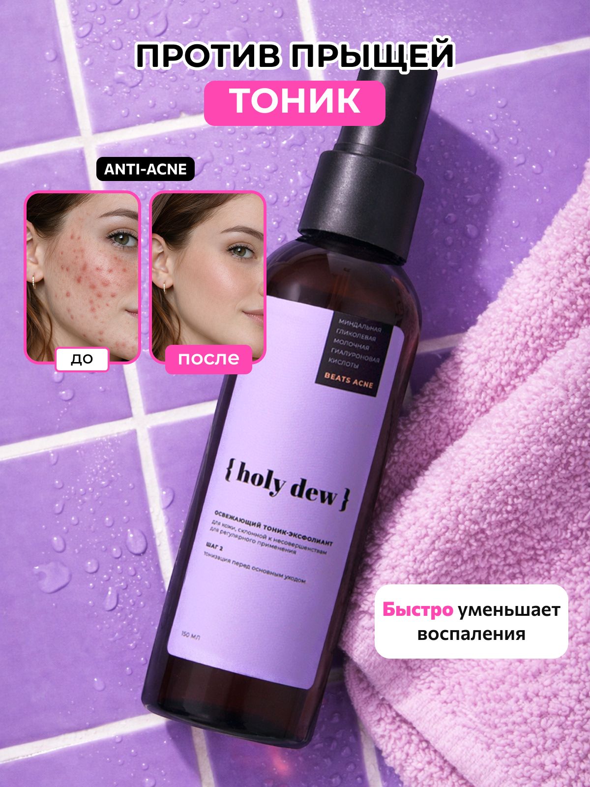 HOLY DEW Тоник для лица и тела с ниацинамидом от прыщей и черных точек, 150 мл