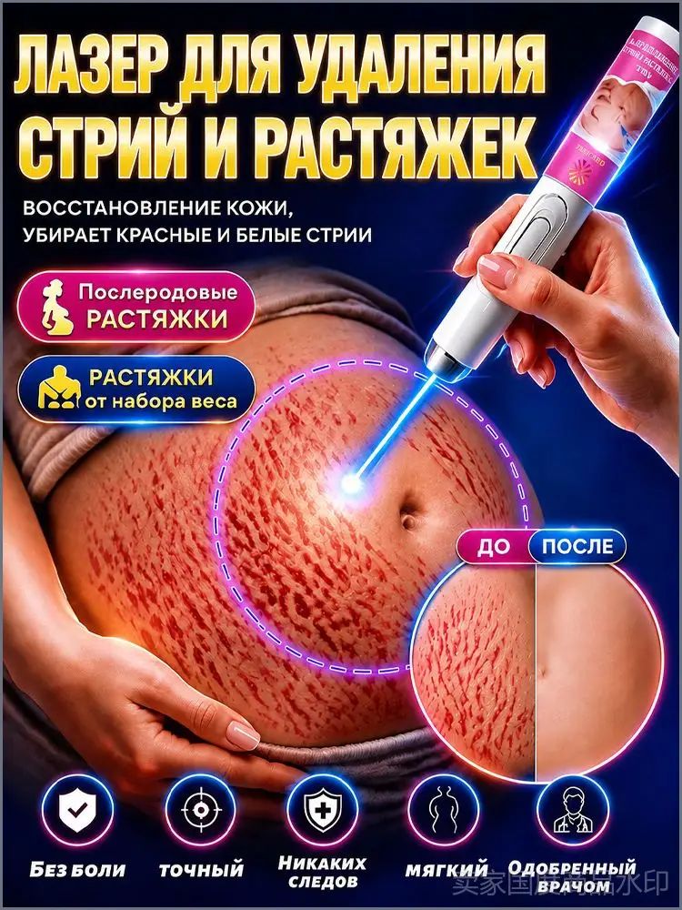 Удаляйте растяжки и отеки синей лазерной указкой, улучшайте старые и новые атрофические морщины, уход за телом на животе
