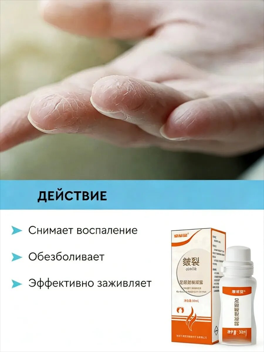 Крем для ног от трещин 30 мл