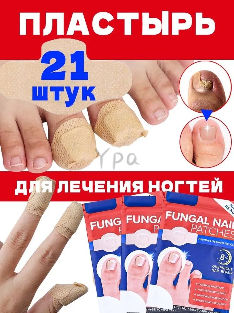 1 коробка/21 штук Пластырь для лечения ногтей для борьбы с грибком, коррекции ногтей