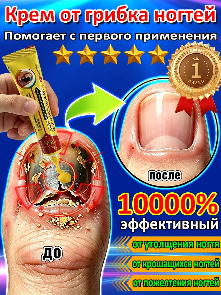 Крем от грибка стоп, уничтожает грибок, снимает зуд и воспаление, глубокое проникновение, предотвращает рецидивы, противогрибковый крем для ног,30 г