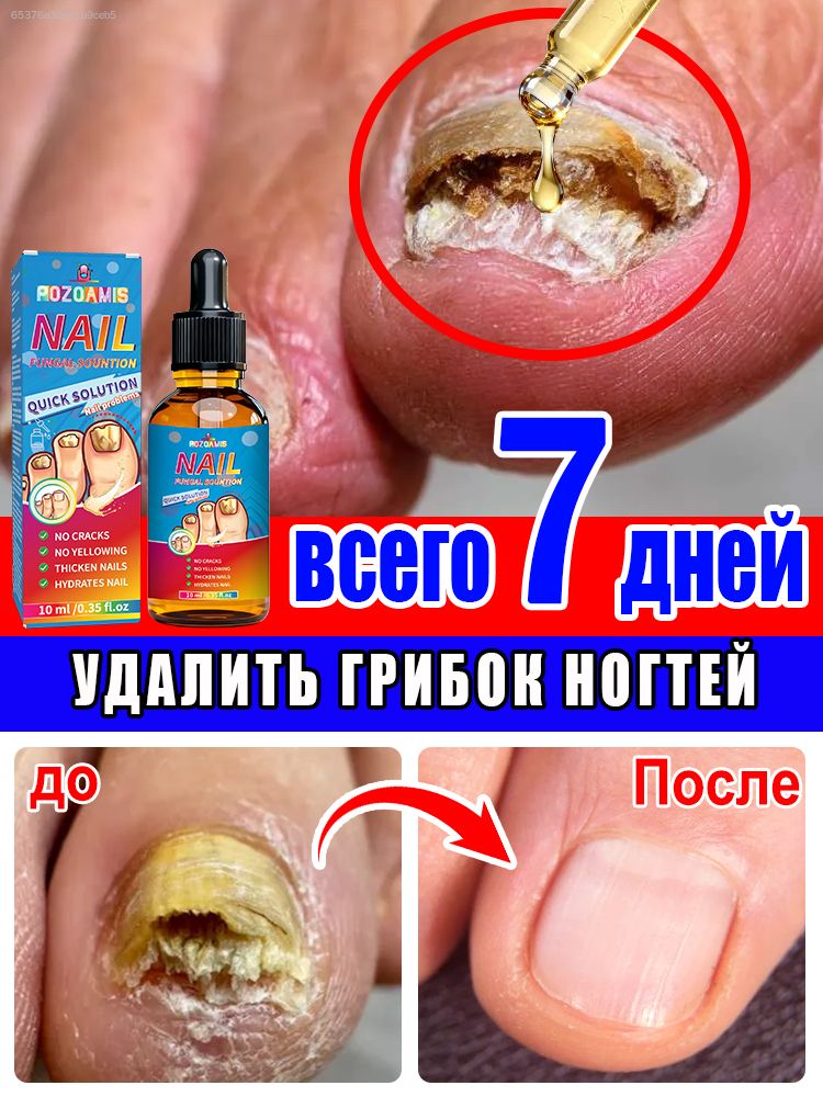 Масло от грибка ногтей. Оно устраняет утолщение, опухание и расслоение ногтей, стимулирует рост и укрепляет ногти, а также обеспечивает уход за ними.10 мл