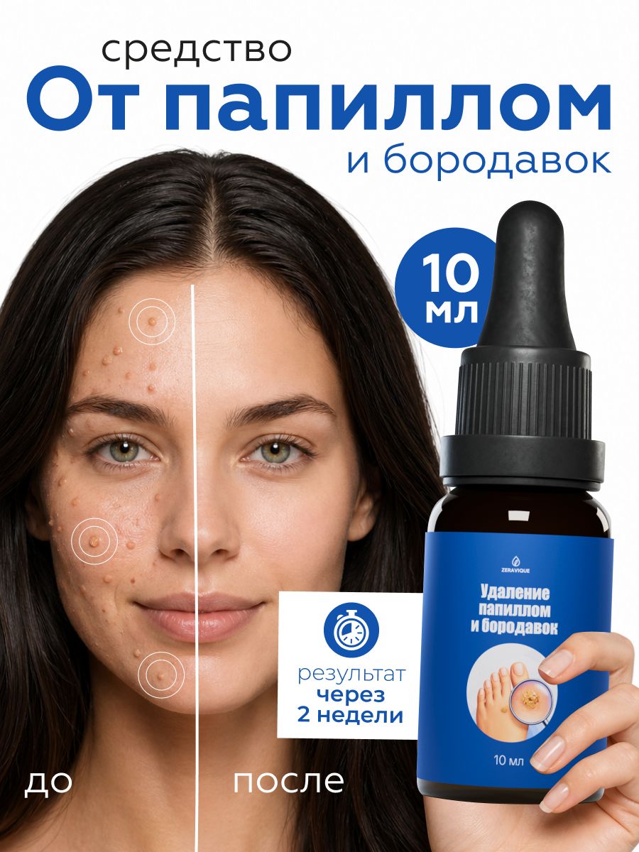 Чистотел от папиллом и бородавок средство PAPIL STOP, 10 мл