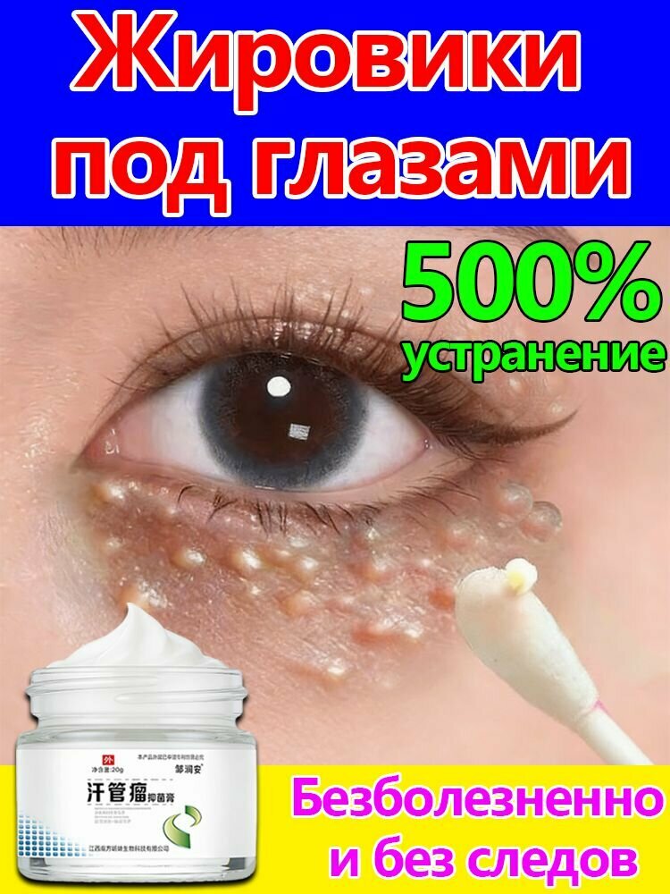 Удаление милиумов под глазами и на веках Быстрое избавление от жировых гранул. Мазь/крем для лечения