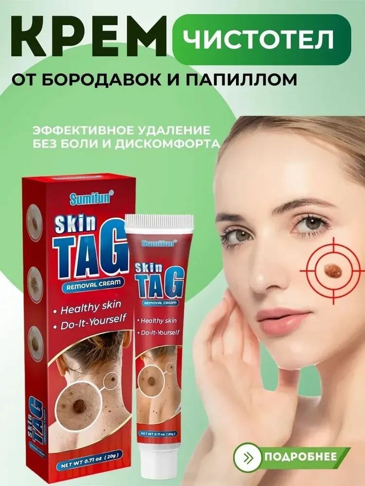 Крем мазь от папиллом и бородавок 20 г