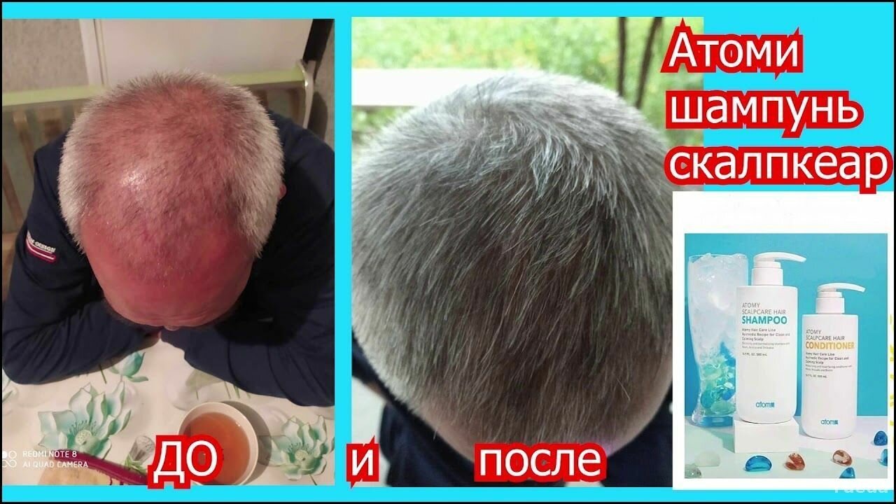 Косметический набор для волос