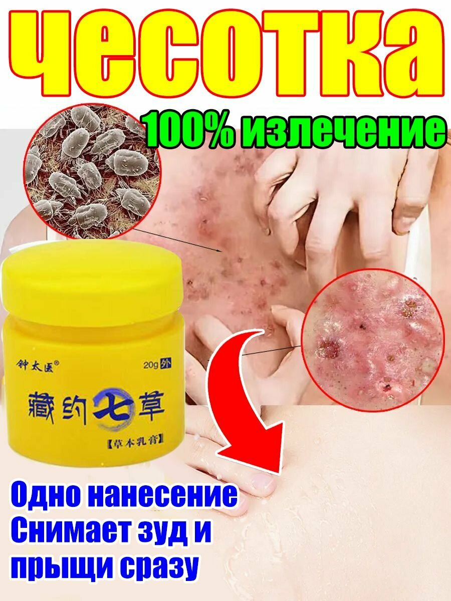 Китайская травяная мазь Пиканван (Pikangwang) от чесотки, демодекоза и зуда кожи, 15 г