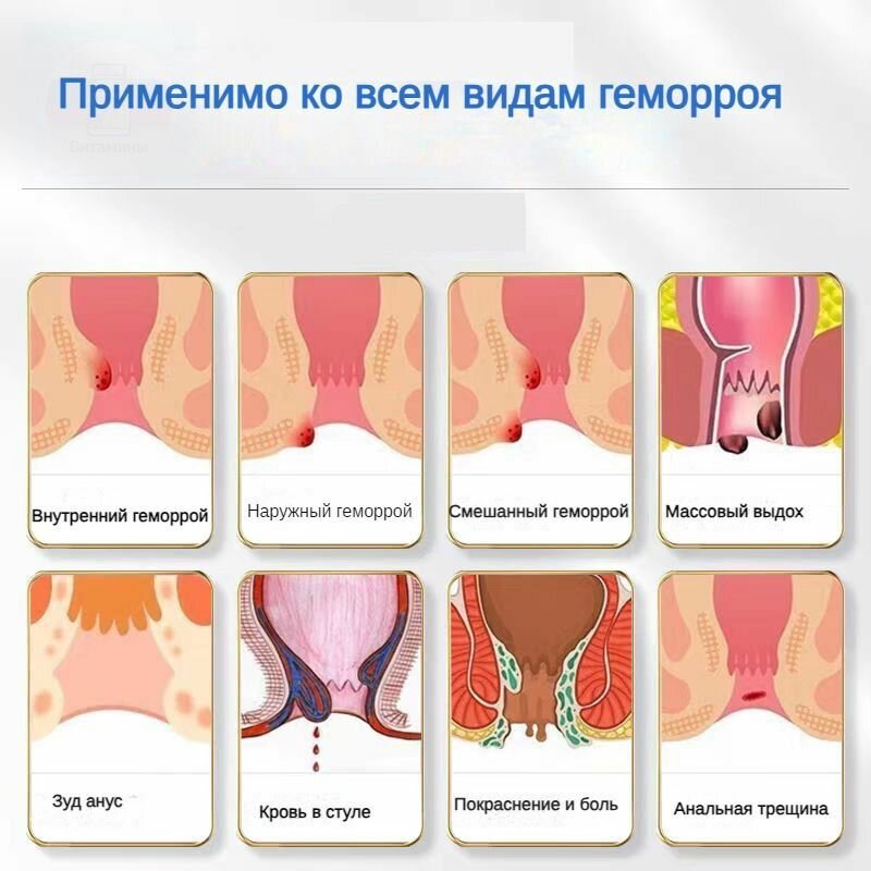 Лечебное средство Китайская мазь от геморроя Чжи Чуан Гао(100% натуральная), 15 гр.