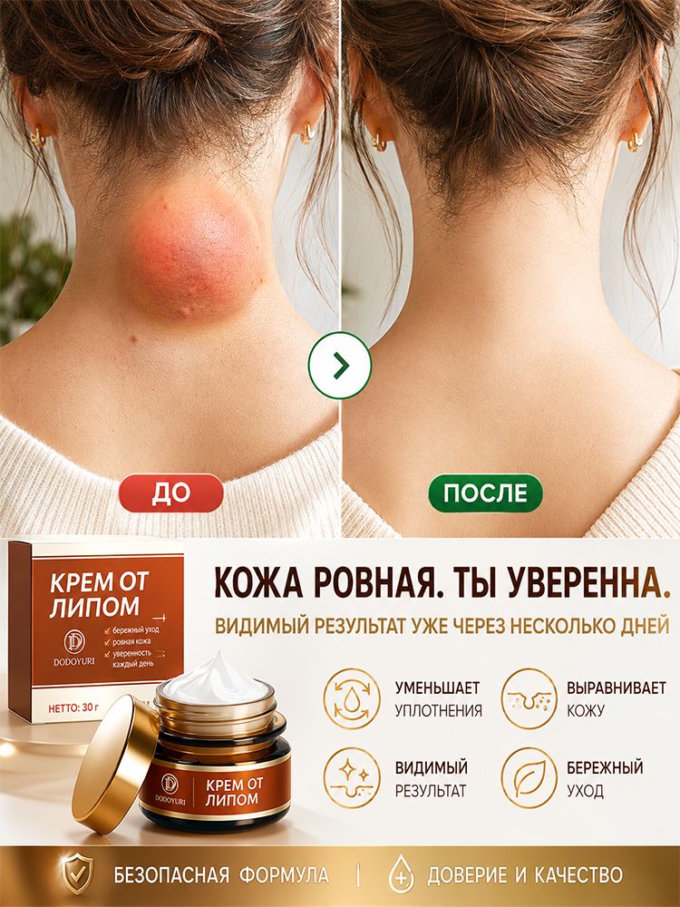 DODOYURI Крем от липом и жировиков, для гладкости и комфорта, средство для ухода за проблемными участками кожи тела, 30 мл
