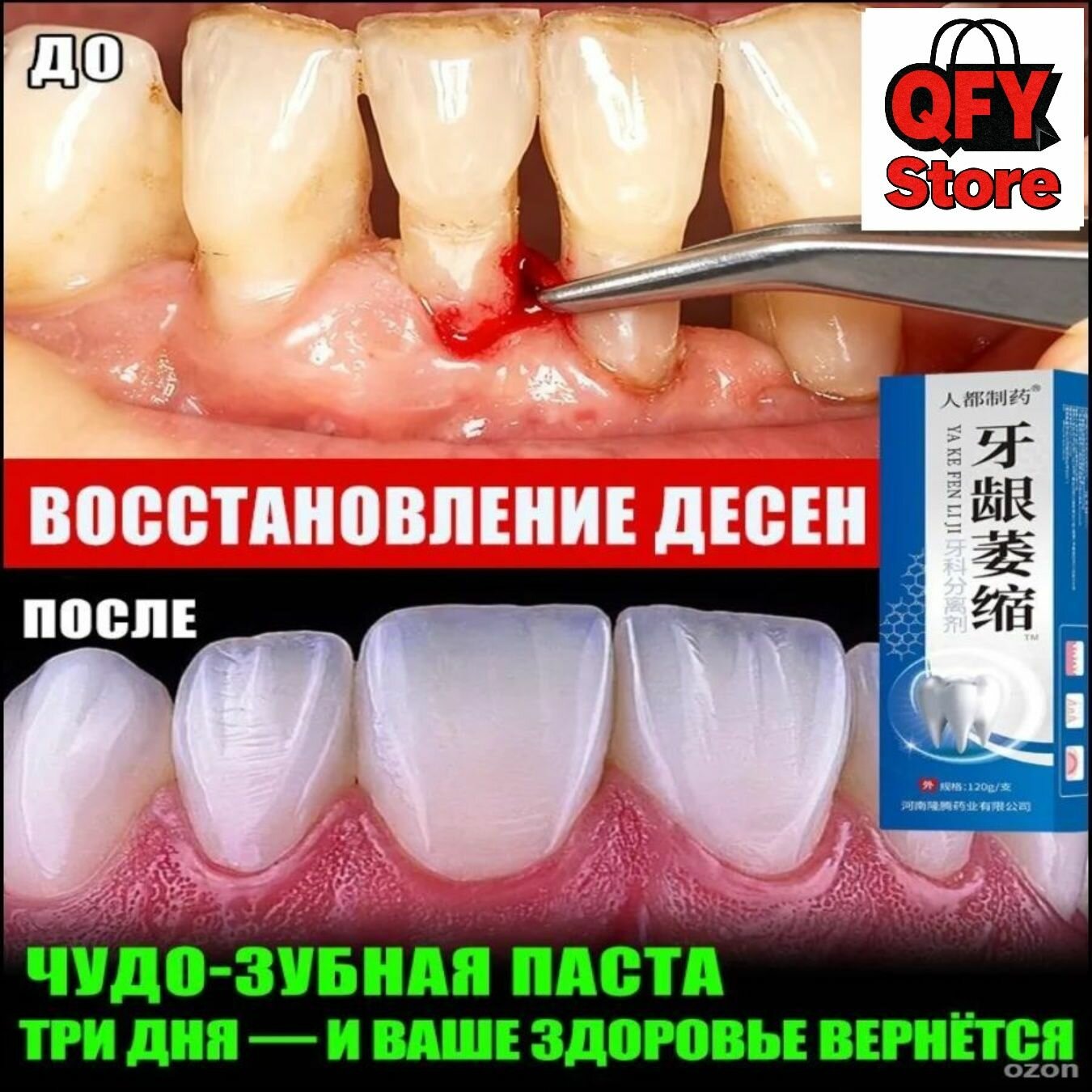 Эксклюзивный бальзам 120 грамм для интенсивной терапии десен при атрофии, стоматите и повышенной чувствительности, гарантирующий премиум антибактериальную защиту ротовой полости