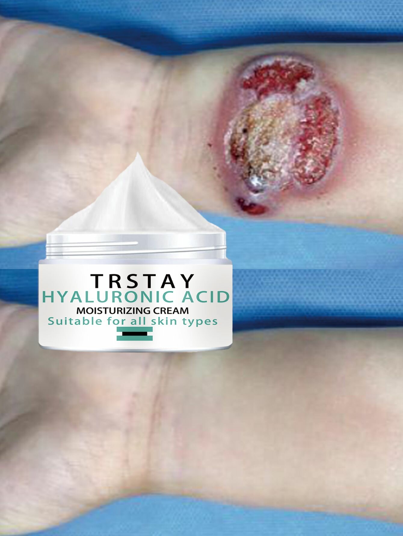 Увлажняющий крем для тела содержит гиалуроновую кислоту для улучшения качества кожи подходит для людей с поврежденной кожей