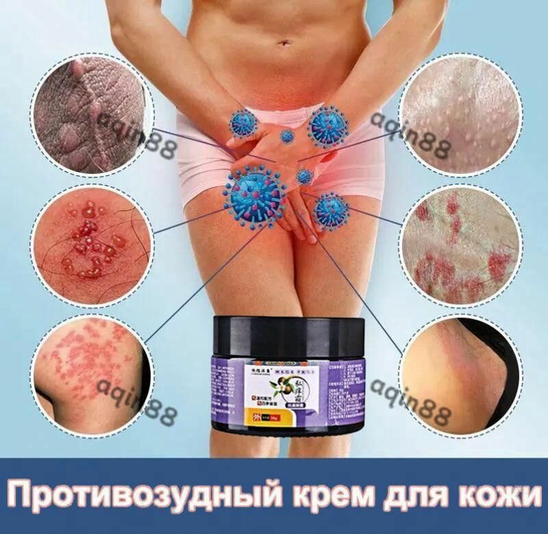 Успокаивающий крем-гель от зуда, воспаления и раздражения в интимных местах 30 г