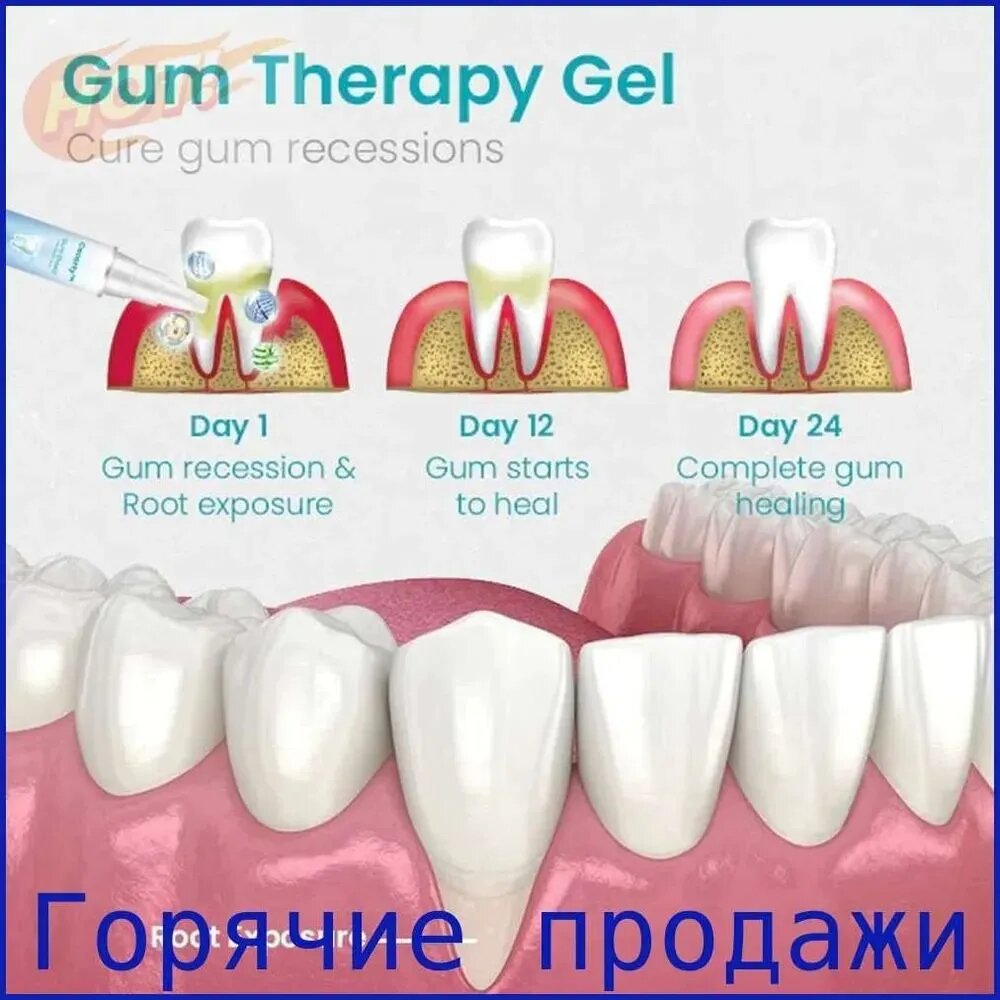 Гель для лечения десен-ds