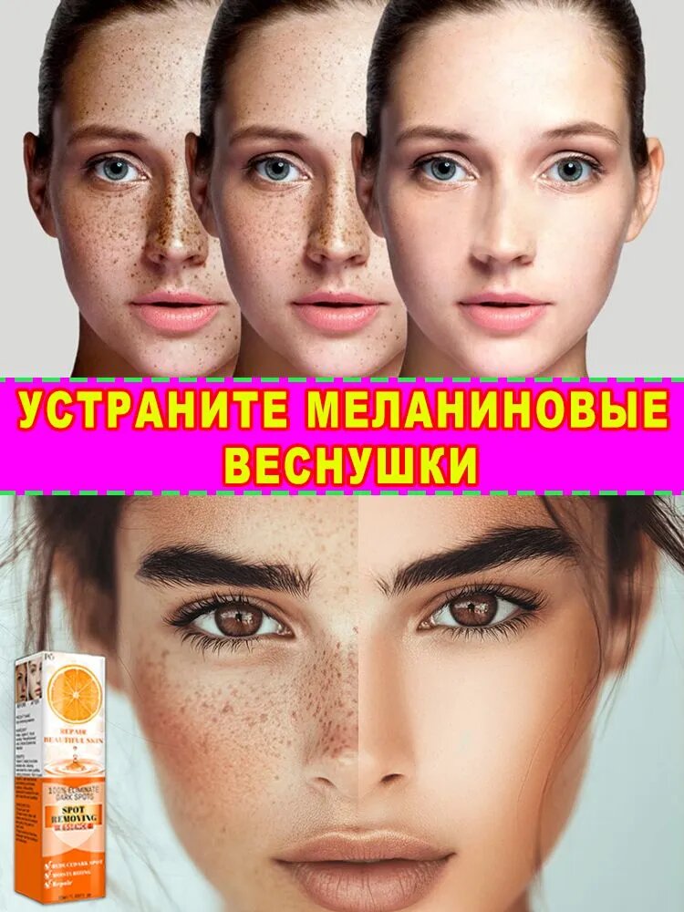 Отбеливающая и против веснушек эссенция эффективно удаляет пигментные пятна, хлоазму, веснушки, солнечные пятна, предотвращает пигментацию, устраняет желтизну и осветляет тон кожи. 90 мл