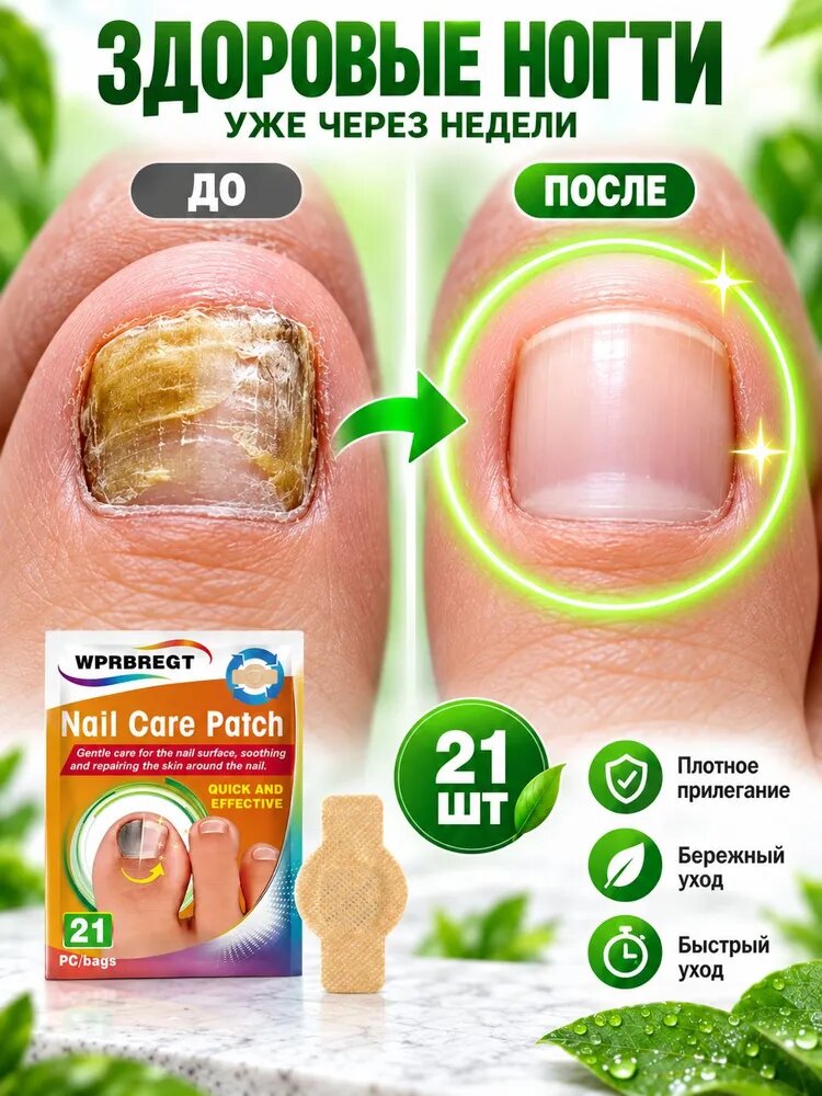 Средство для ухода за ногтями ног, пластырь для ногтей от грибка, защита и восстановление ногтевой пластины, уход за кутикулой. 105шт
