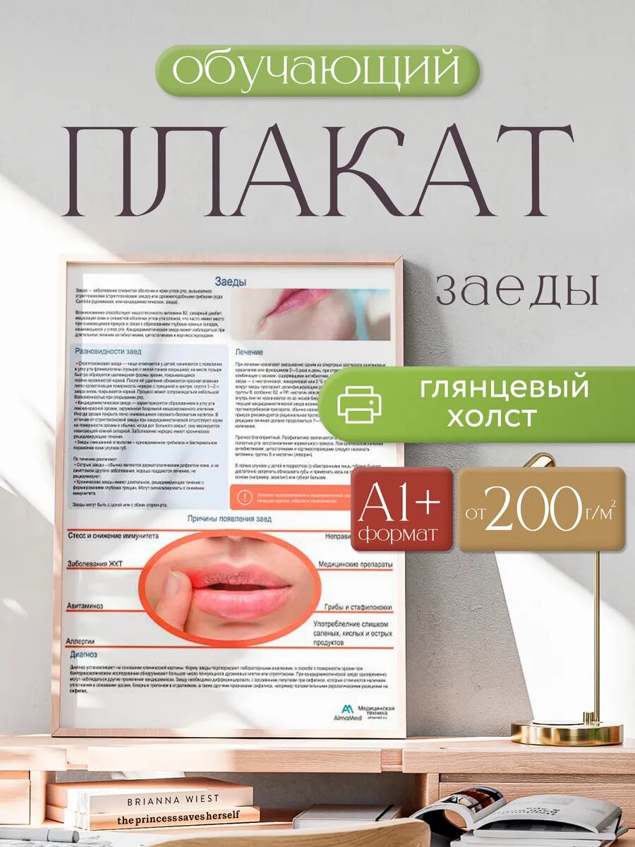Заеды медицинский плакат А1+, глянцевый холст от 200г/м2