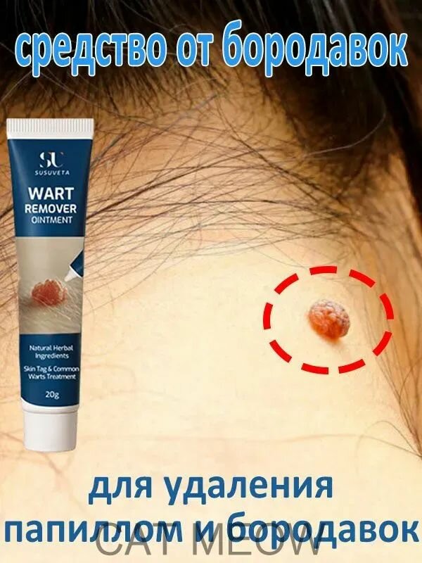 Мазь от бородавок, Крем средство для удаления бородавок, папиллом и родинок, безболезненно, не оставляет следов без побочных эффектов / 20г