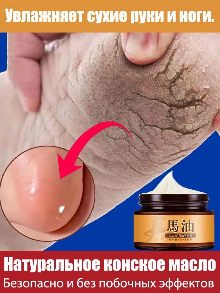 Крем для ног с лошадиным маслом, для сухой и грубой кожи, от мозолей, зуда, трещин, повреждений и шелушениями, облегчение боли, 30г