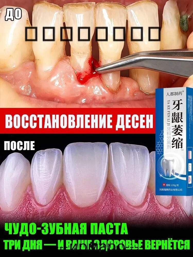 При атрофии десен/чувствительных зубах/стоматите и уходе за деснами/антибактериальные средства для ухода за полостью рта 120г