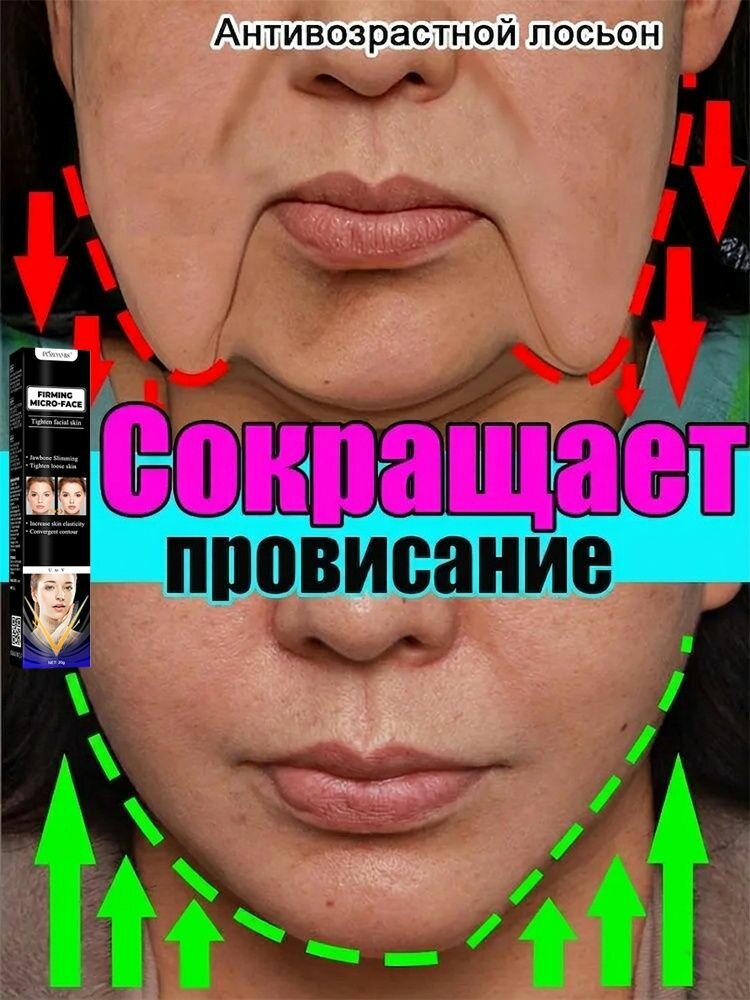 Крем для лица v-образной формы. Это помогает устранить жировые отложения на лице, убрать двойной подбородок, подтянуть мимические морщины и уменьшить тусклость кожи.